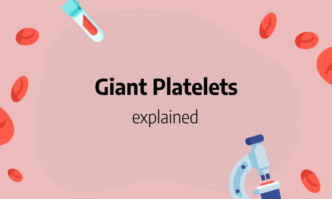 Giant Platelets: Definition, Causes, Symptoms and Treatment