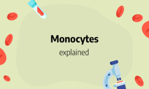 Monocytes: low, high, absolute count and normal range, causes
