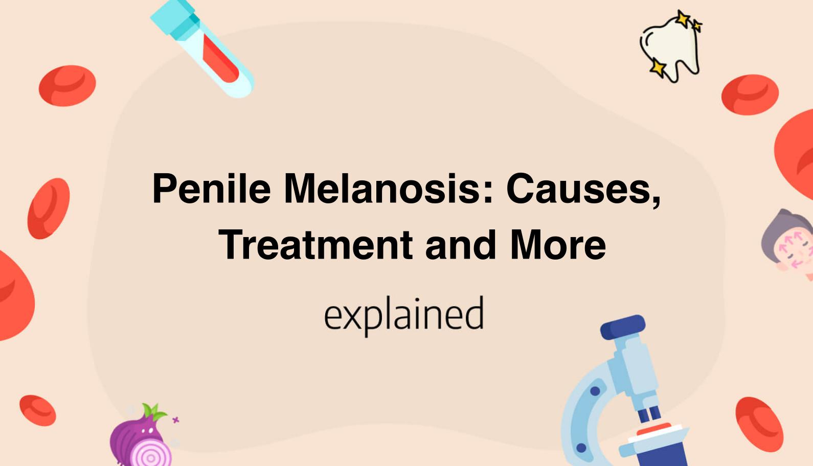 Penile Melanosis: Causes, Treatment and More