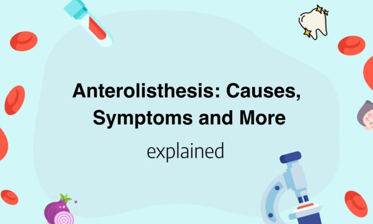 Anterolisthesis: Causes, Symptoms and More